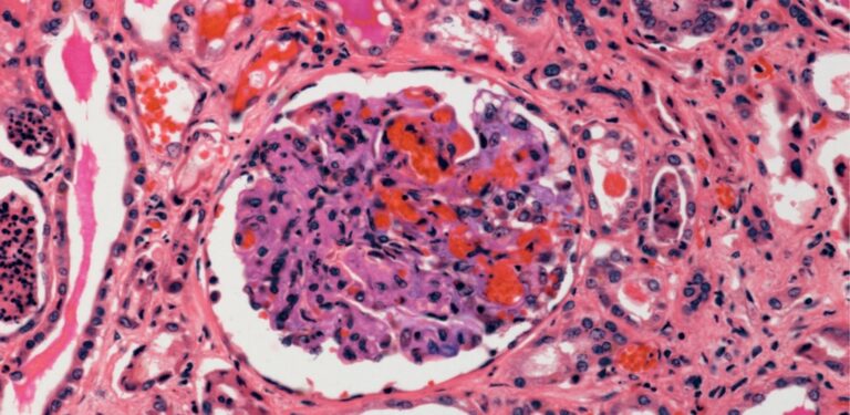 Rapid Artifact Removal and H&E-Stained Tissue Segmentation ...